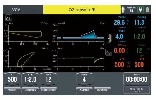 X30 Anesthesia Workstation with 4 tube flowmeter, peep valve, N2O+O2 ...